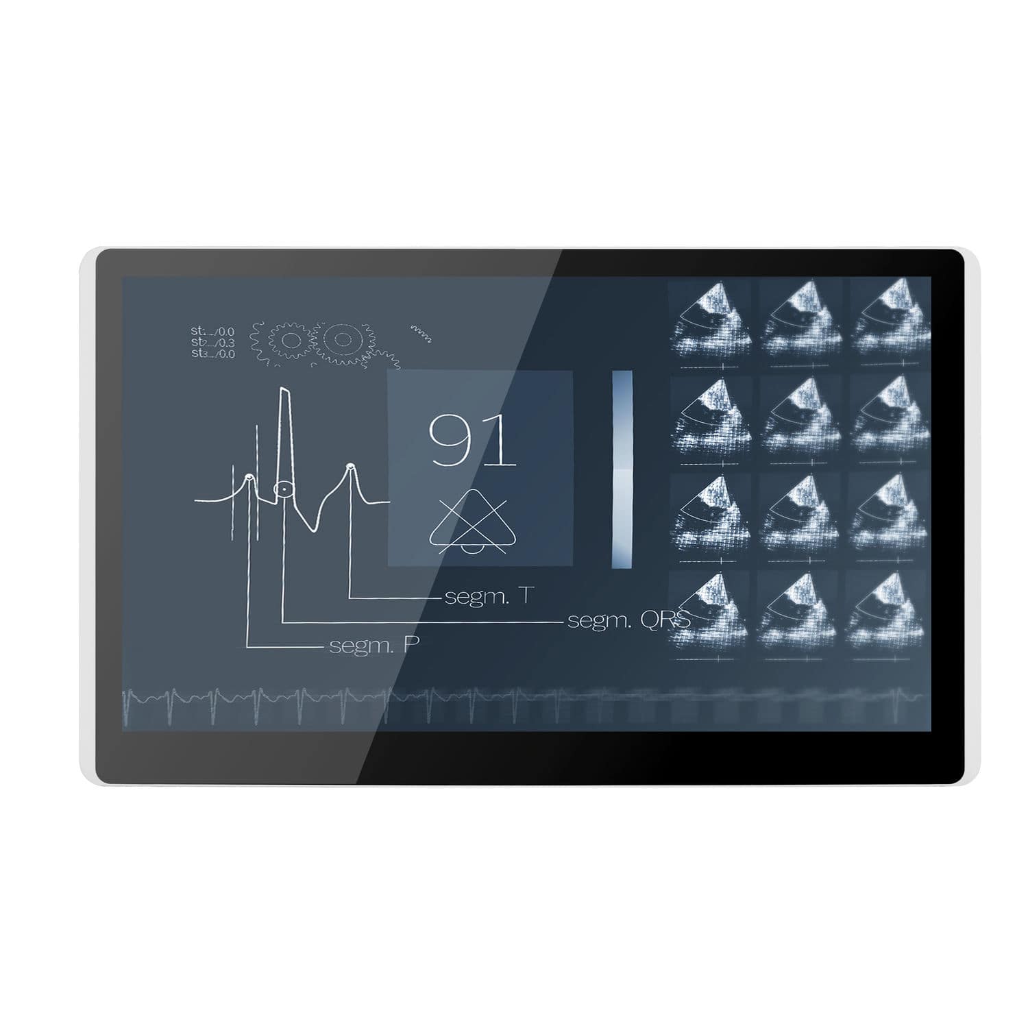 TFT monitor - W15L100-PTA3-ME - Winmate, Inc. - multi-touch screen / 15.6" / 1920 x 1080