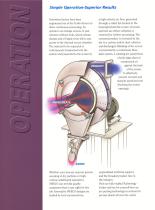 Turbo-Screen Air Classifiers - SWECO - PDF Catalogs | Technical ...